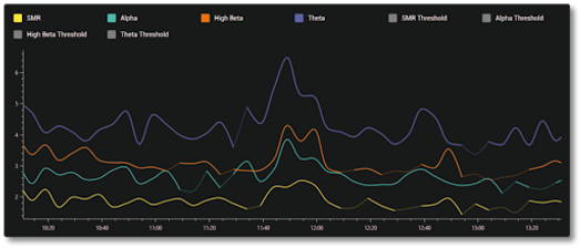 BrainAssistant | Neurofeedback Software